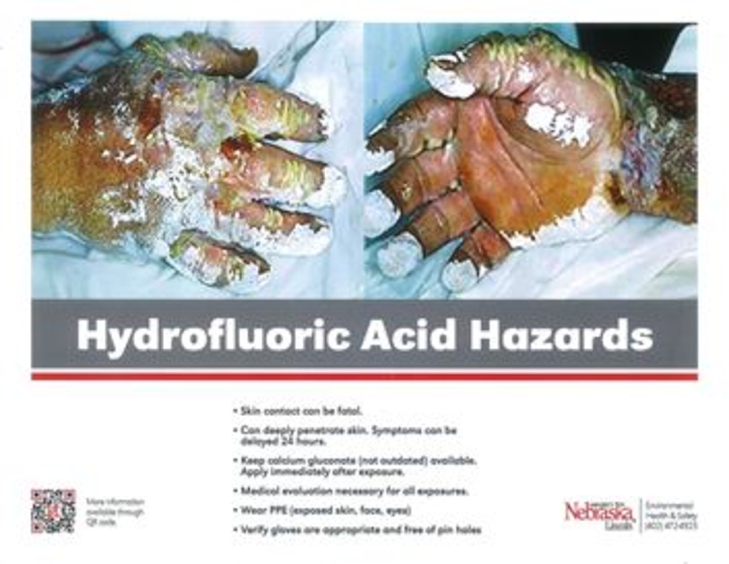 Safety Posters | Environmental Health & Safety | Nebraska